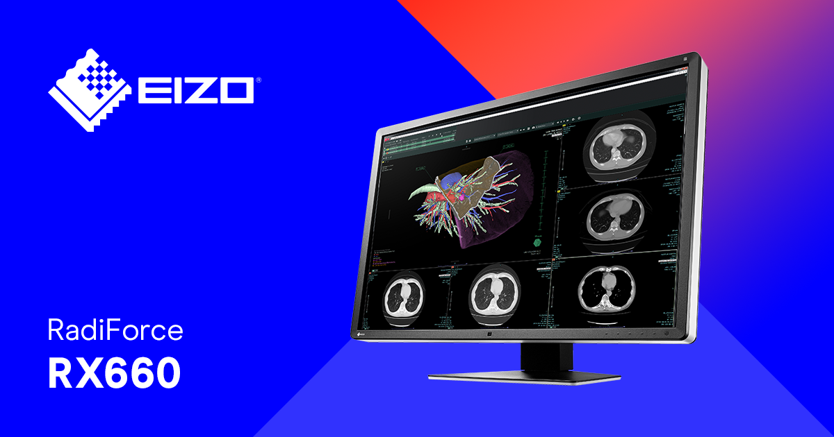 RadiForce RX660 | 6 MP diagnostic monitor (color)