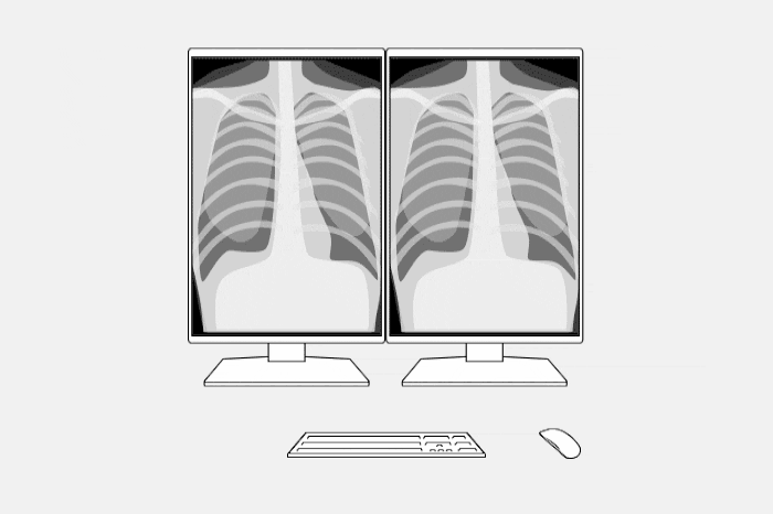 EIZO monitors for teleradiology
